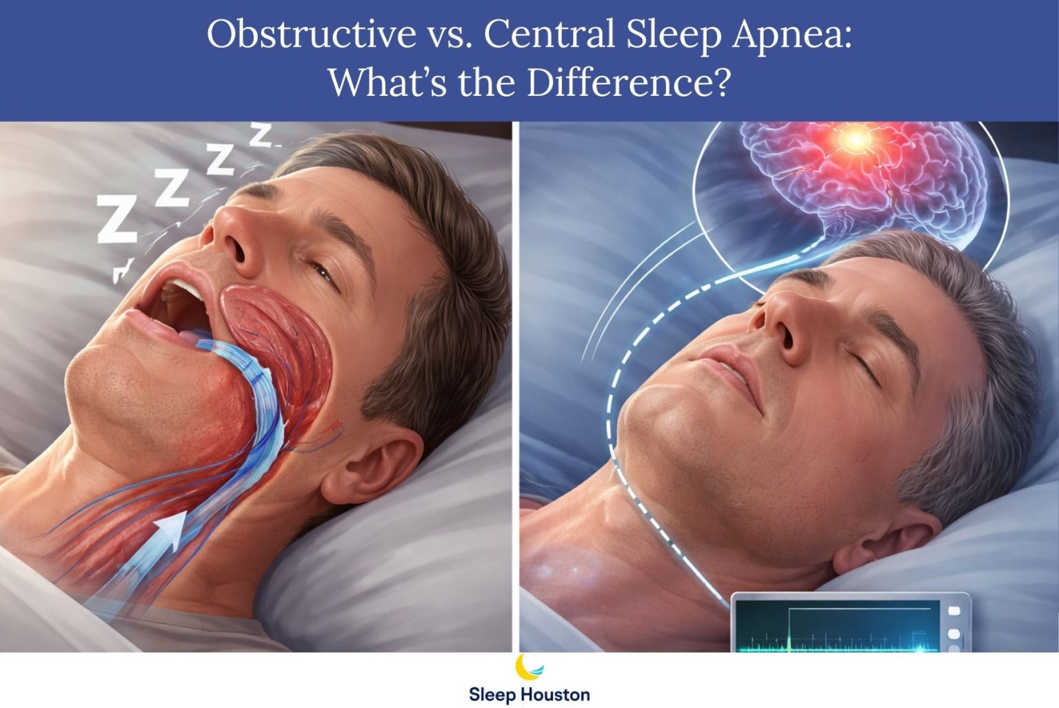 Obstructive vs. Central Sleep Apnea: What’s the Difference? | Sleep ...