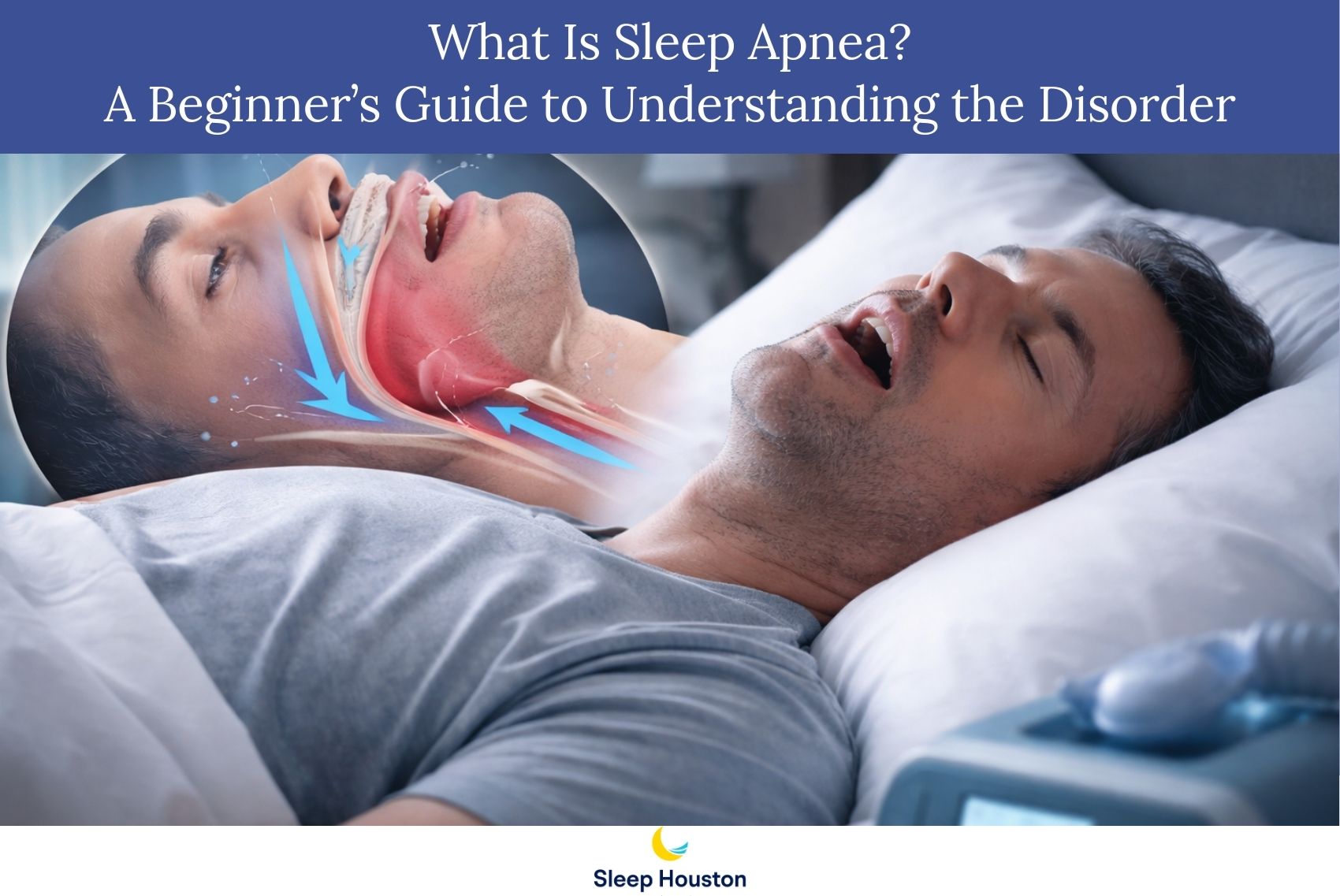 What Is Sleep Apnea? A Beginner’s Guide to Understanding the Disorder ...